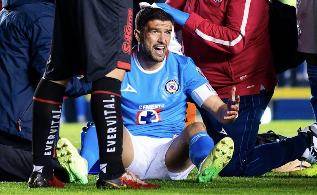 Cruz Azul: El escalofriante dato sobre la lesión que sufrió Ignacio Rivero
